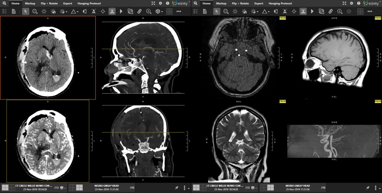Enterprise Diagnostic Viewing - Mach7 Technologies