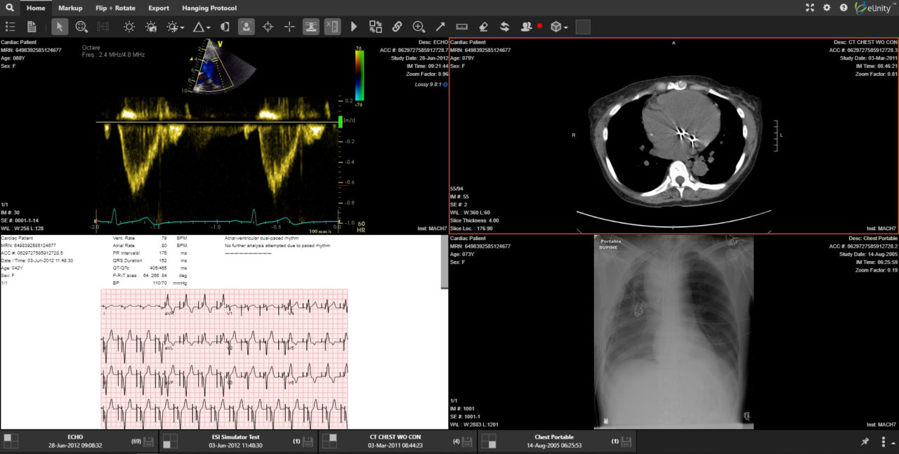 Enterprise Diagnostic Viewing - Mach7 Technologies
