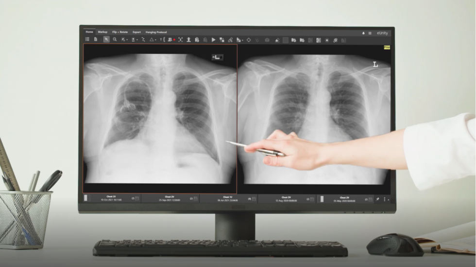 Collateral - Mach7 Technologies