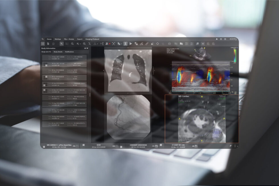 eUnity Viewer Landing Page - Mach7 Technologies