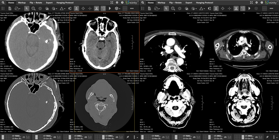 UnityVue - Mach7 Technologies
